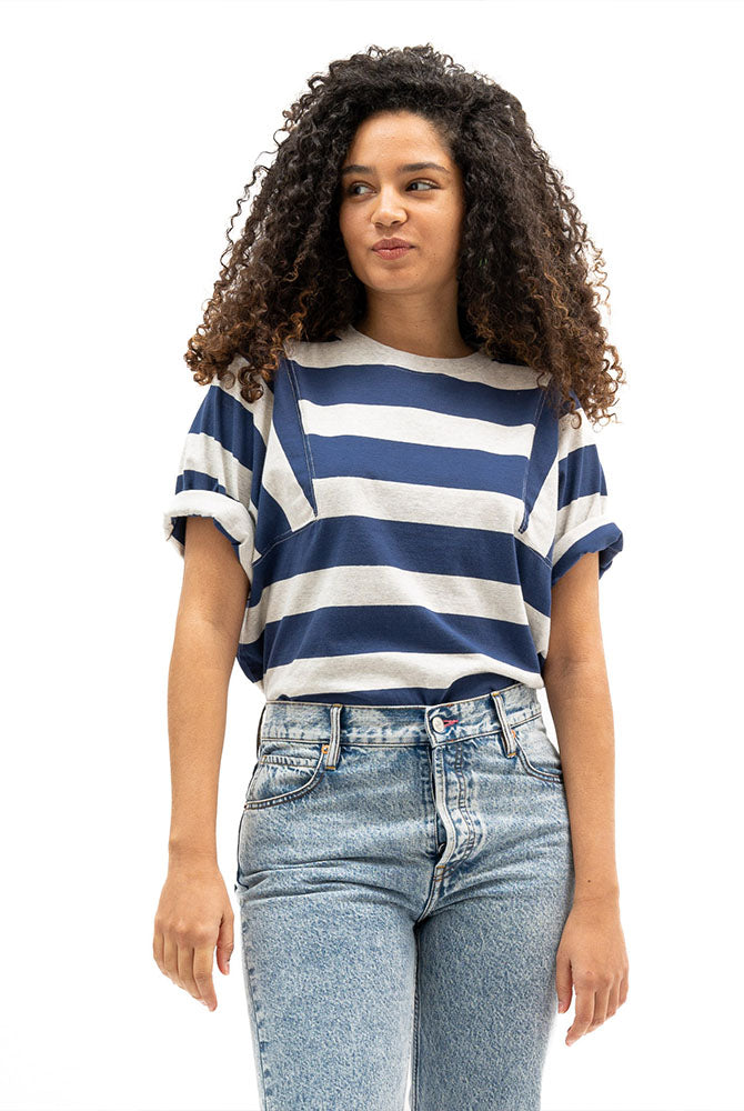 Guide : tout savoir sur les rayures de l’été ! – Patine